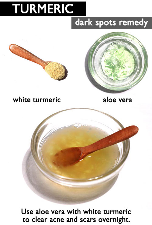 Diy Spot Treatment For Dark Spots - Here S How To Remove Age Spots ...